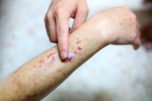 Red Spots on Skin: Causes, Symptoms, and When to Seek Help – The ...