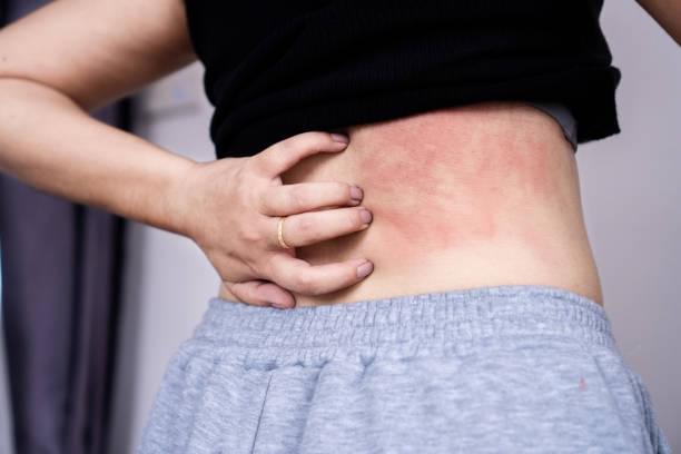 Natural Remedies for Itchy Skin: 10 Proven Ways to Stop the Itch – The ...